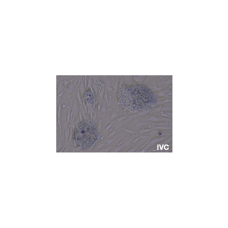 Evident Olympus Inverted microscope Olympus CKX53 with stage drive ...