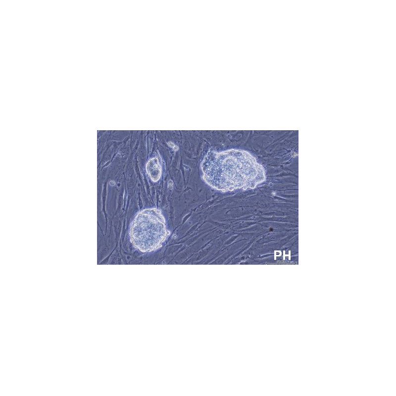 Evident Olympus Inverted microscope Olympus CKX53 with stage drive ...